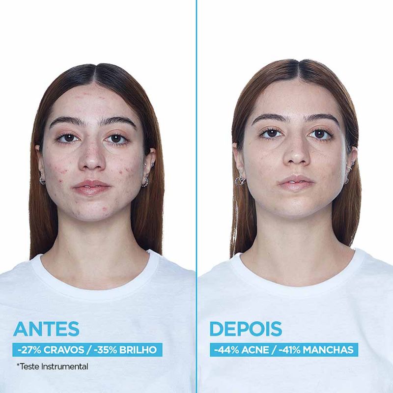 Sérum Facial Garnier Uniform & Matte Antiacne - Época Cosméticos ...